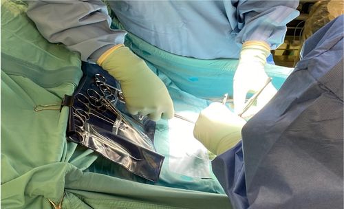 Use Case for Disposable Forceps Pocket